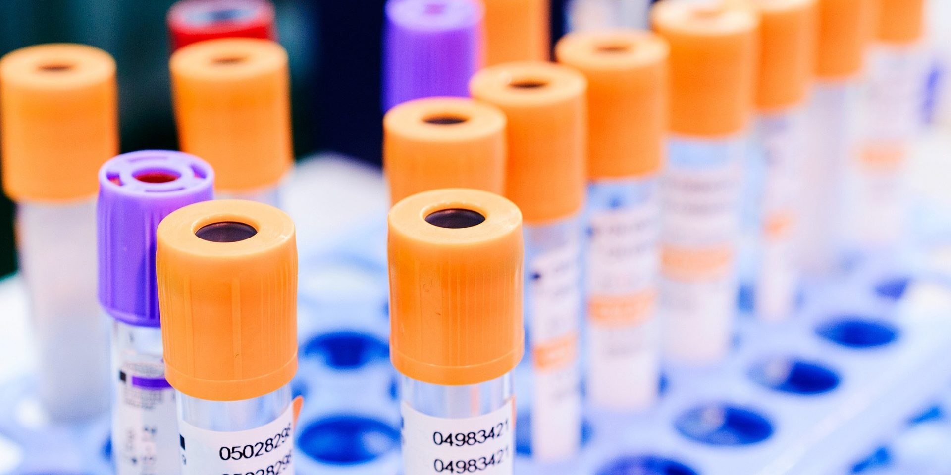 Veja como otimizar a gestão de armazenamento de material biológico ...